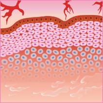 Vagidonna.fi | Vaihdevuosien aiheuttamaan emättimen kuivuuteen